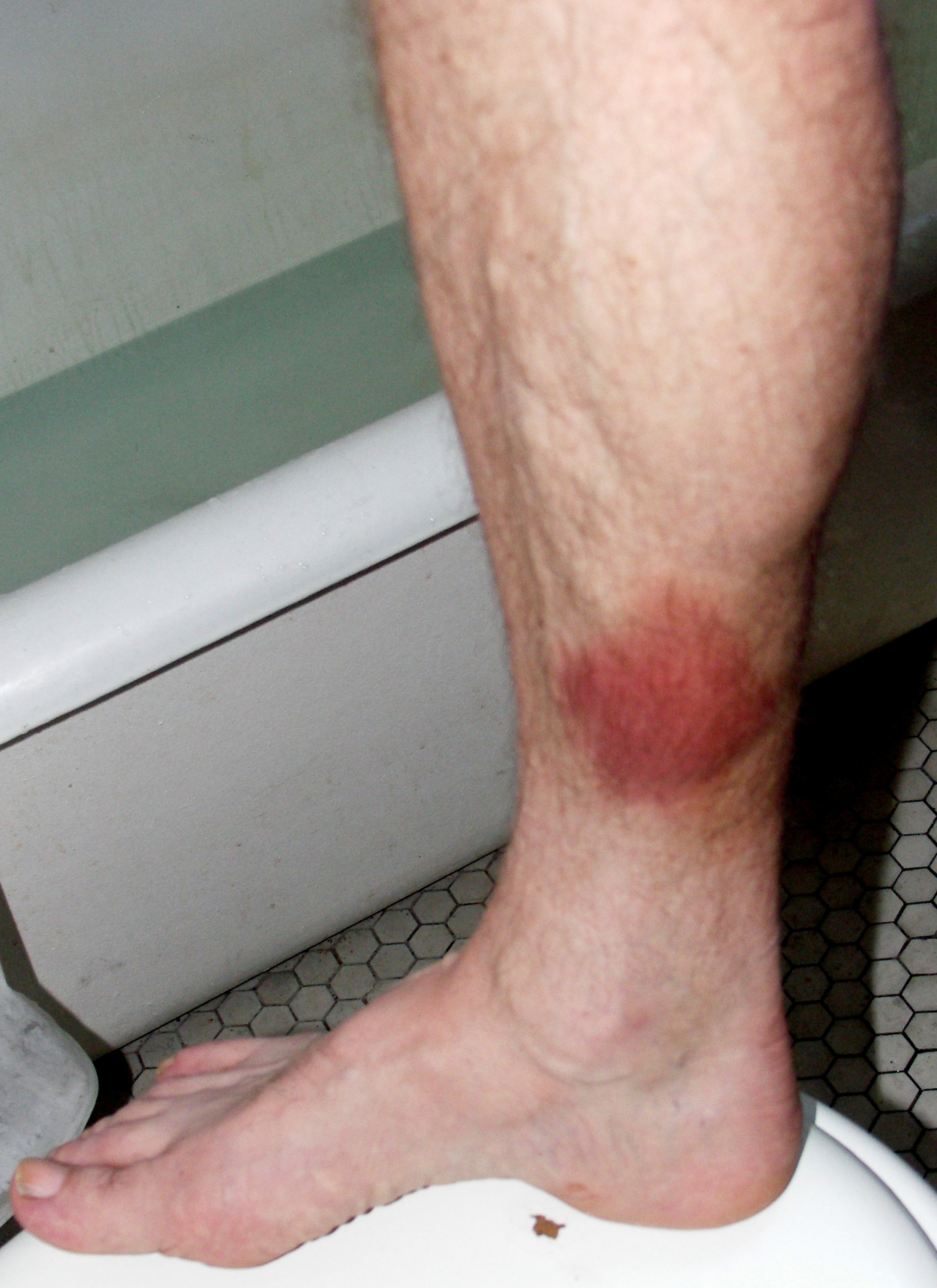 Running and activism – Quakers and Mutual Aid